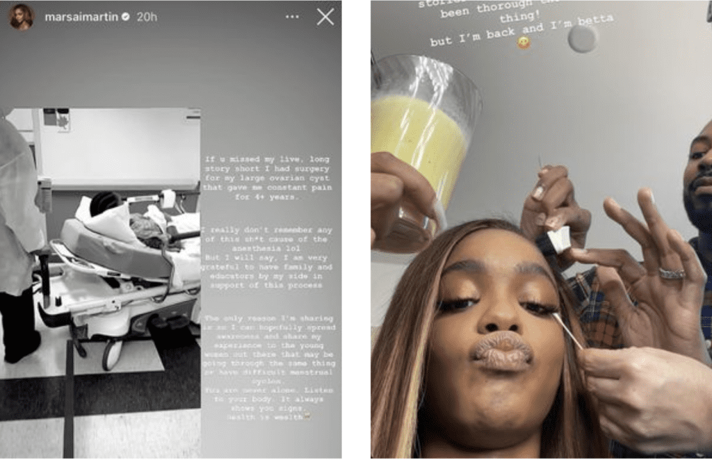 Marsai Martin Gets Ovarian Cyst Removed After 4 Years of 'Constant Pain ...